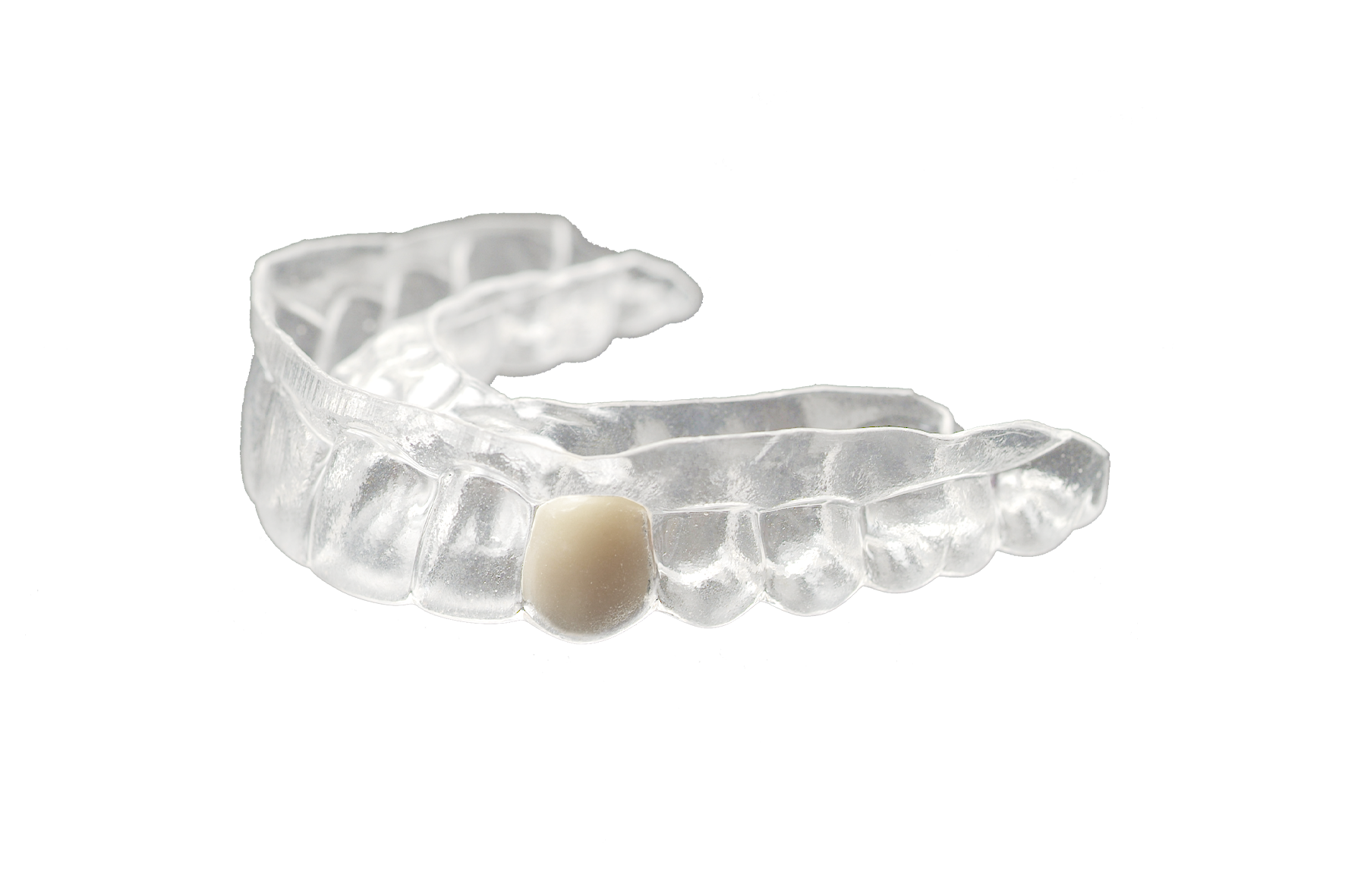 Essix Pontics: Shop online | Dentsply Sirona USA