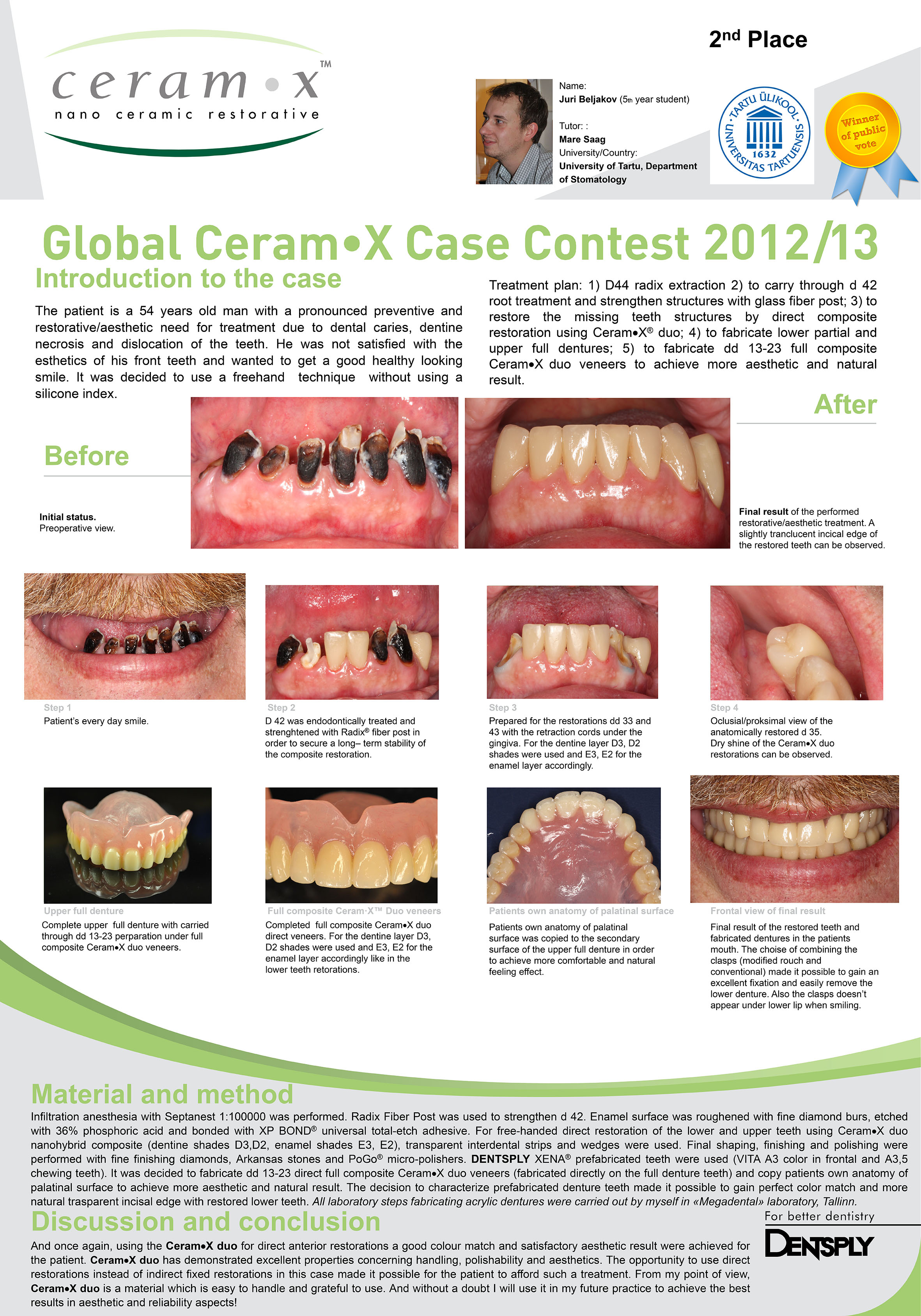 GCCC Global Clinical Case Contest I Dentsply Sirona USA