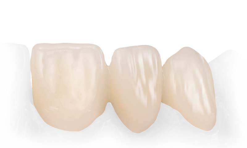 Cercon xt ML | Dentsply Sirona Österreich