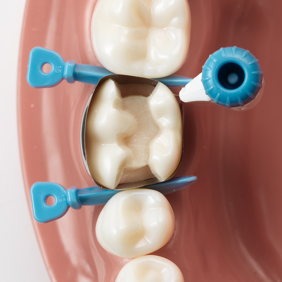 Palodent 360: Vollmatrizensystem | Dentsply Sirona Österreich