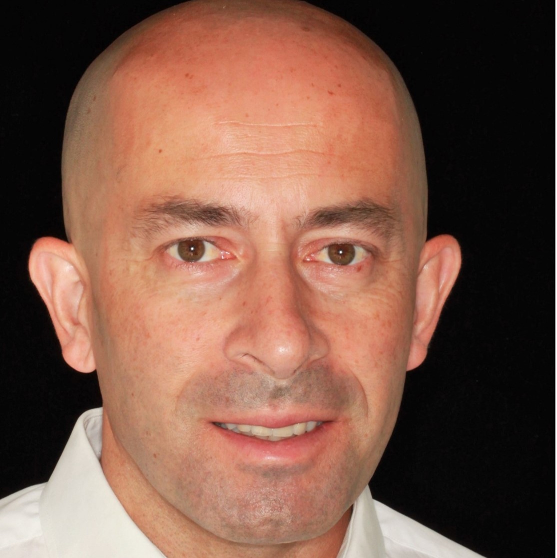 Klasse II, Abt. 1 – Protrusion des zentralen Schneidezahns und ...