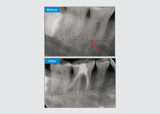 Klinischer Fall im Fokus: Mehr erfahren! | Dentsply Sirona Deutschland