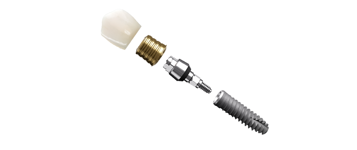 Acuris Abutment nach konometrischem Konzept | Dentsply Sirona Deutschland
