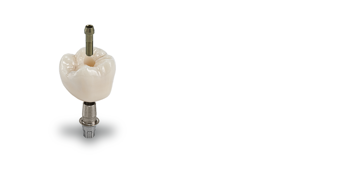 CEREC Tessera: CAD/CAM Blöcke | Dentsply Sirona Deutschland