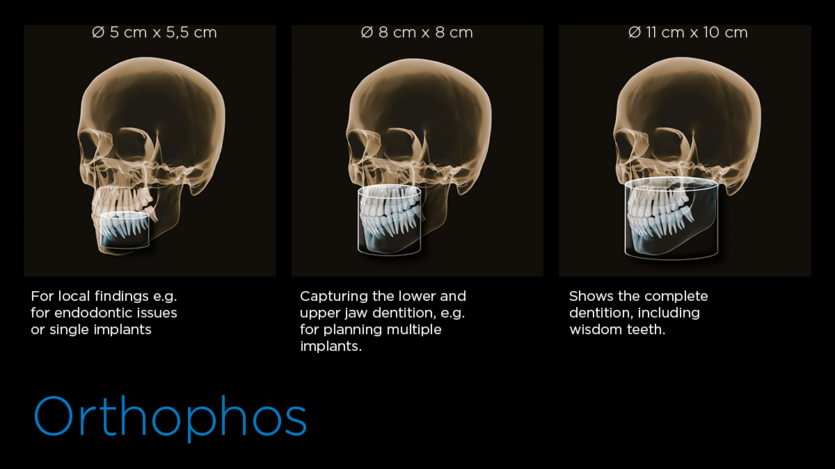 Orthophos SL 3D und 2D: Röntgengeräte | Dentsply Sirona Deutschland