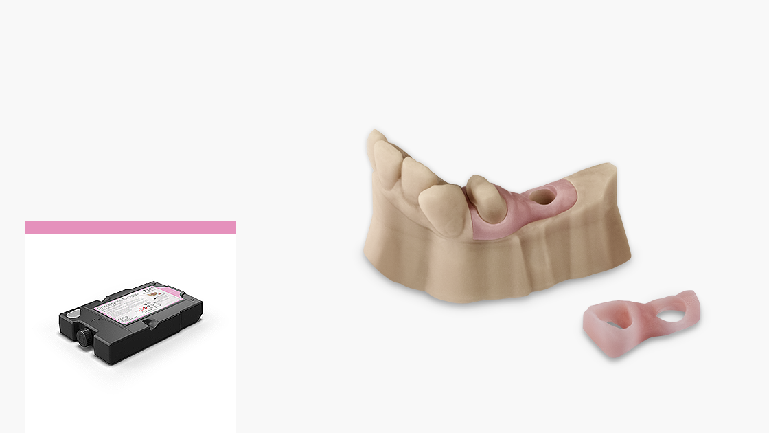 Primeprint Indikationen | 3D-Druckmaterialien in der Zahnmedizin | Dentsply Sirona Deutschland