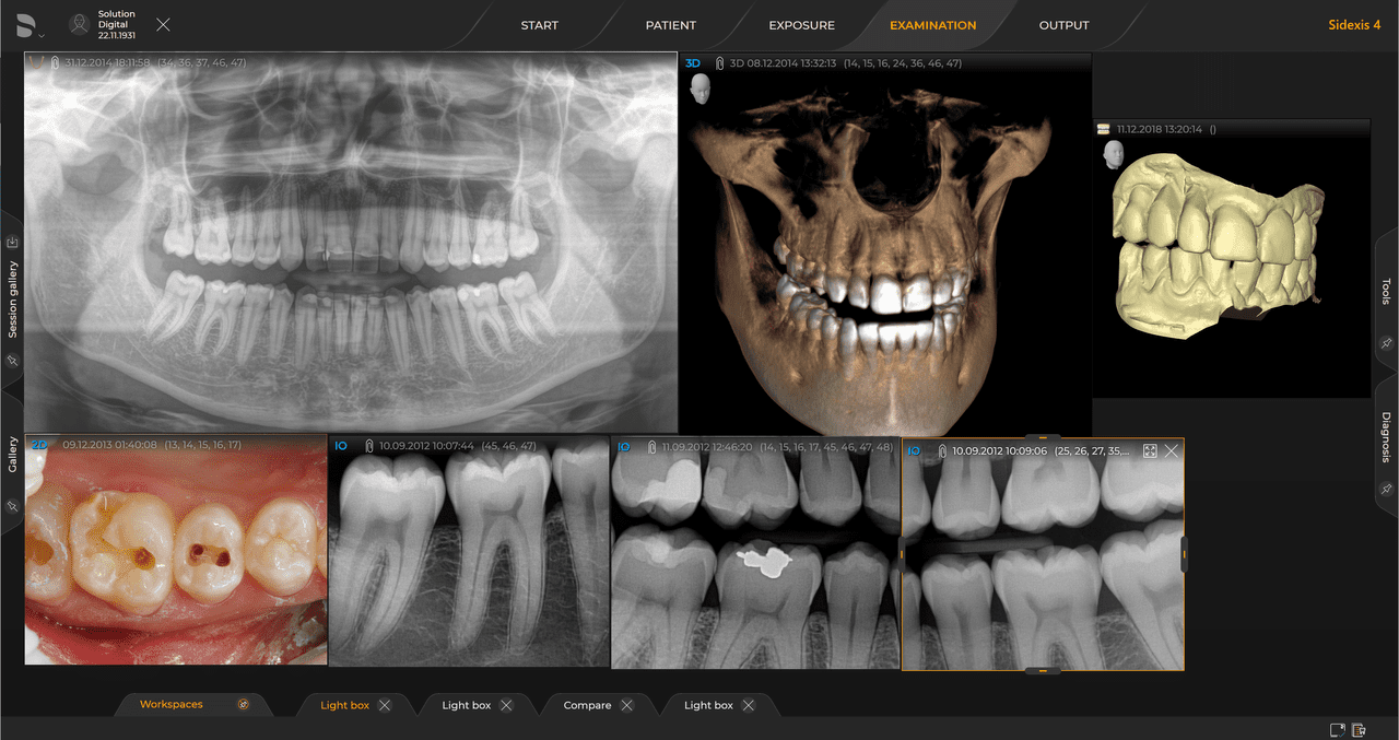DS Signature Workflow für Endodontie | Dentsply Sirona Deutschland