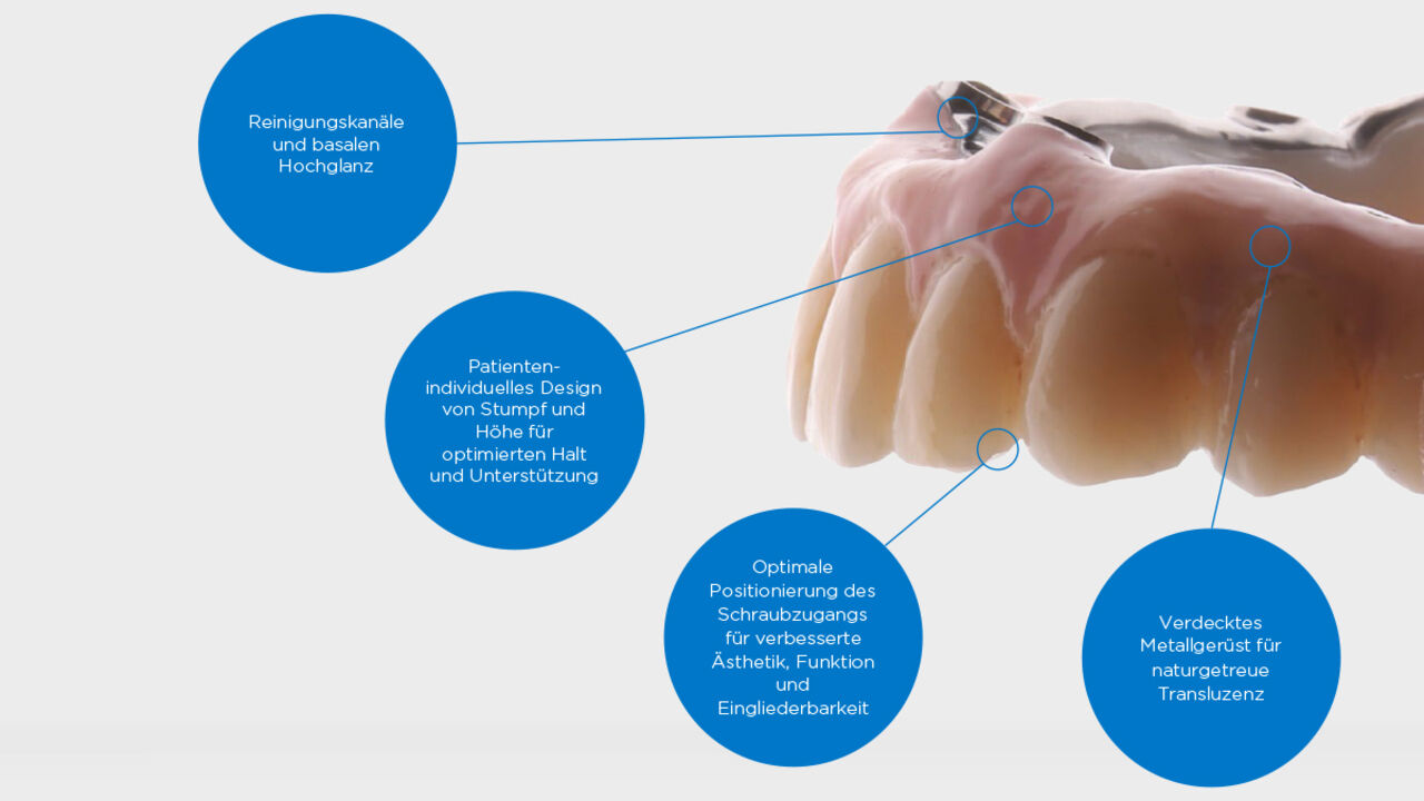 Atlantis BridgeBase Deutschland