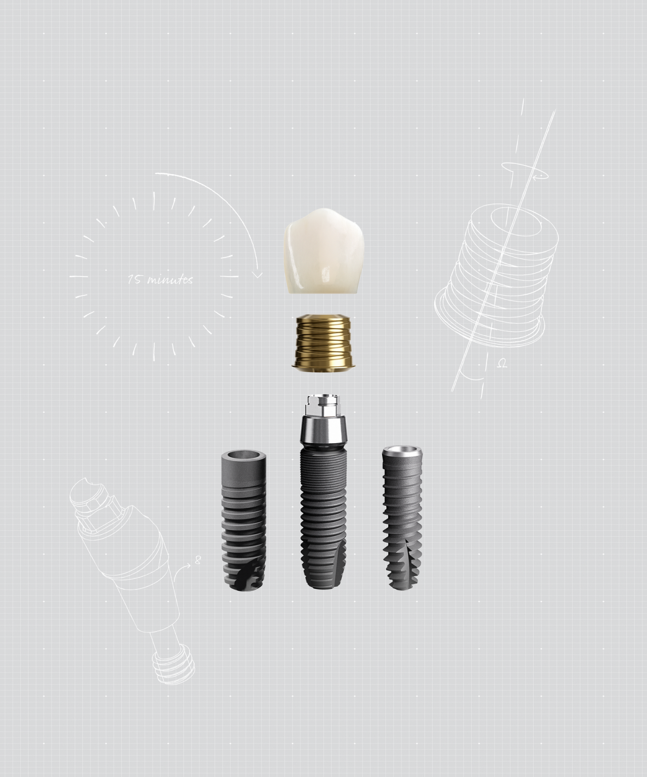 Acuris Conometric Implant Abutment | Dentsply Sirona MENA