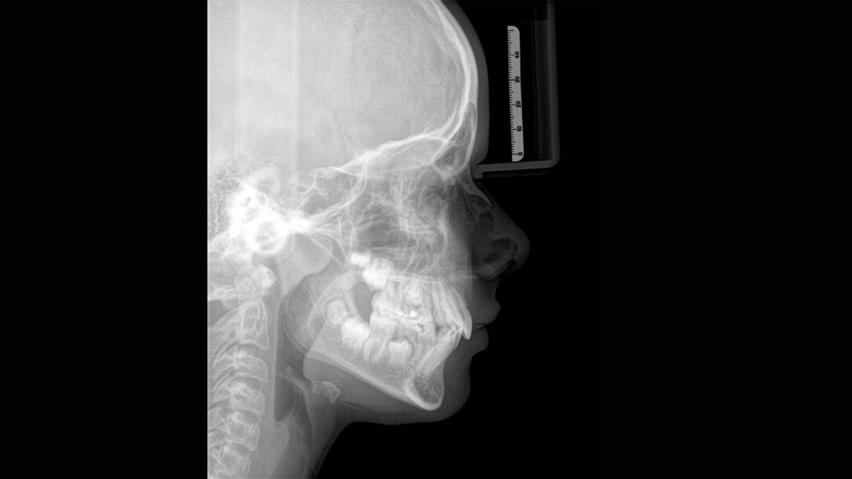 Axeos CBCT Machine | Dentsply Sirona MENA