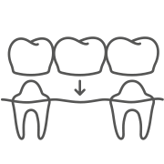CEREC Software | Dentsply Sirona MENA