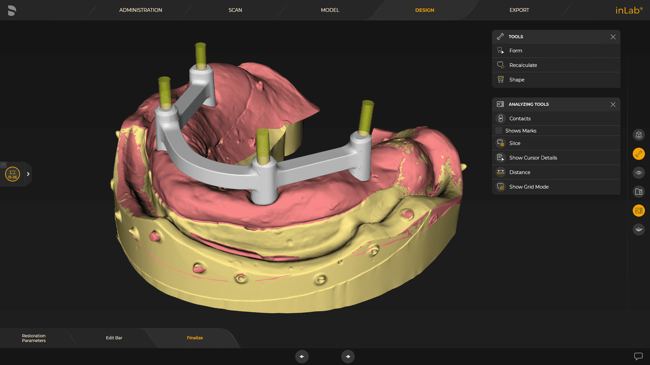 inLab Software: Dental CAD Software | Dentsply Sirona MENA