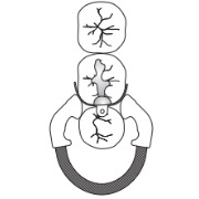 Palodent Matrix Systems | Denstply Sirona MENA