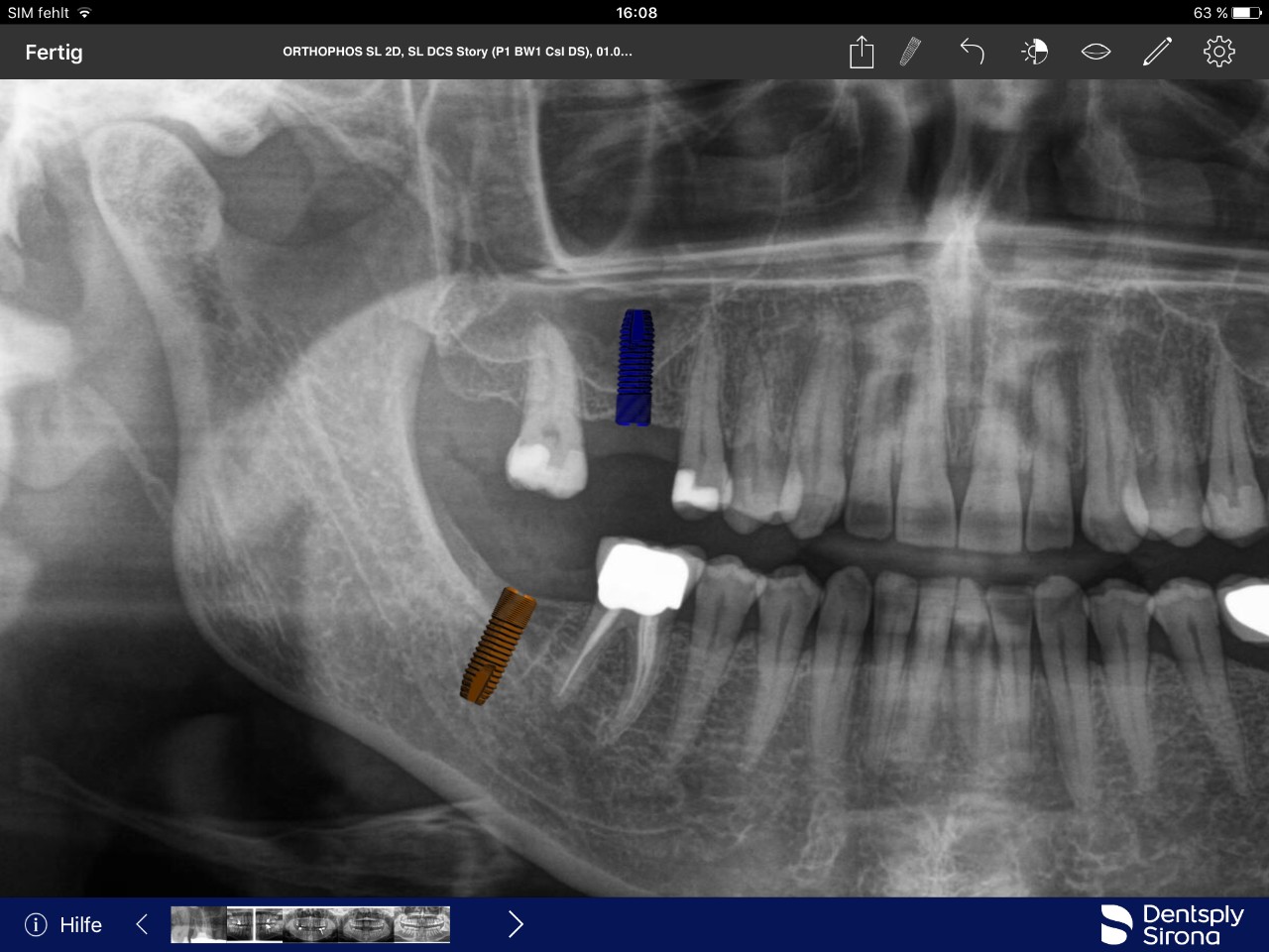 Sidexis iX Dental Imaging iPad App | Dentsply Sirona MENA