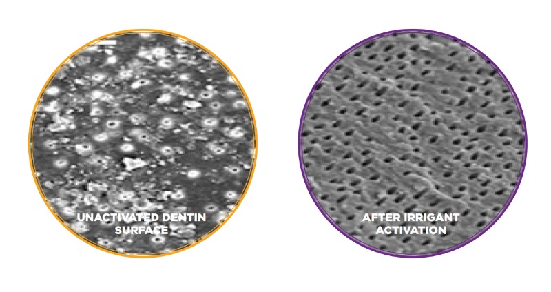 SmartLite Pro EndoActivator | Dentsply Sirona MENA