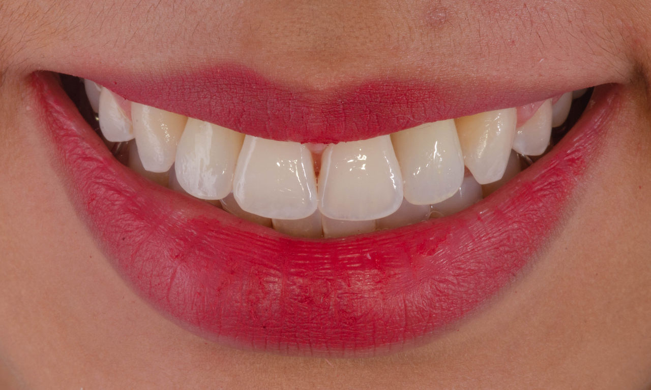 CEREC CAD/CAM Systems | Dentsply Sirona MENA