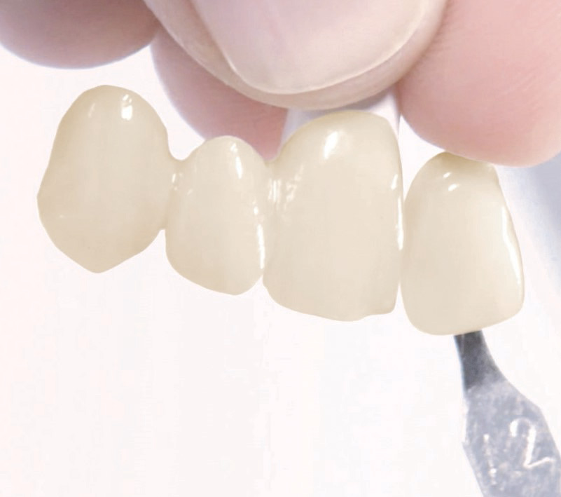 All-Ceramic Crown & Bridge Materials | Dentsply Sirona MENA