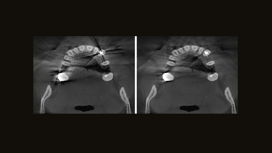 Extraoral X-ray: Discover now! | Dentsply Sirona MENA
