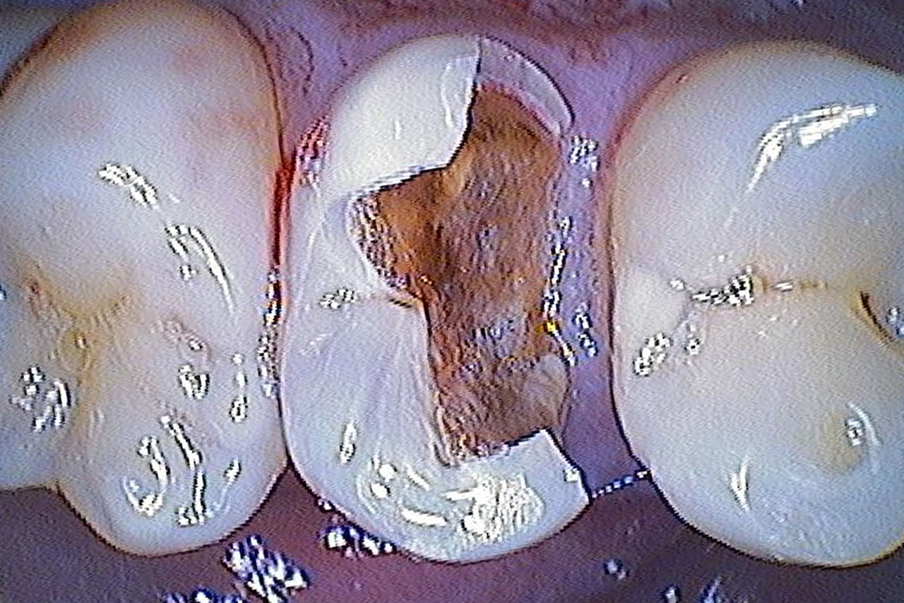 CEREC Case Studies | Dentsply Sirona MENA