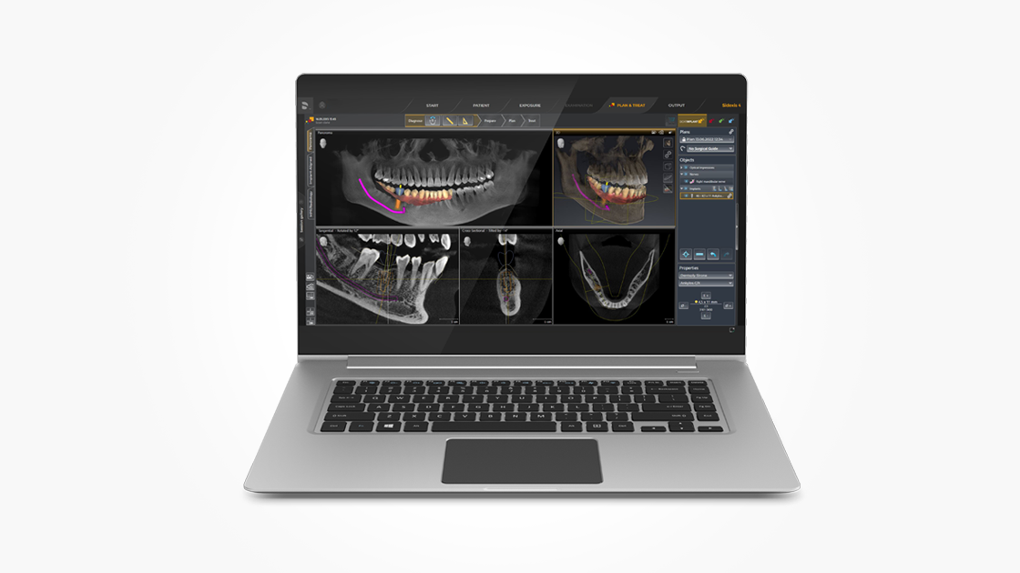 Dental X-Ray Software | Dentsply Sirona