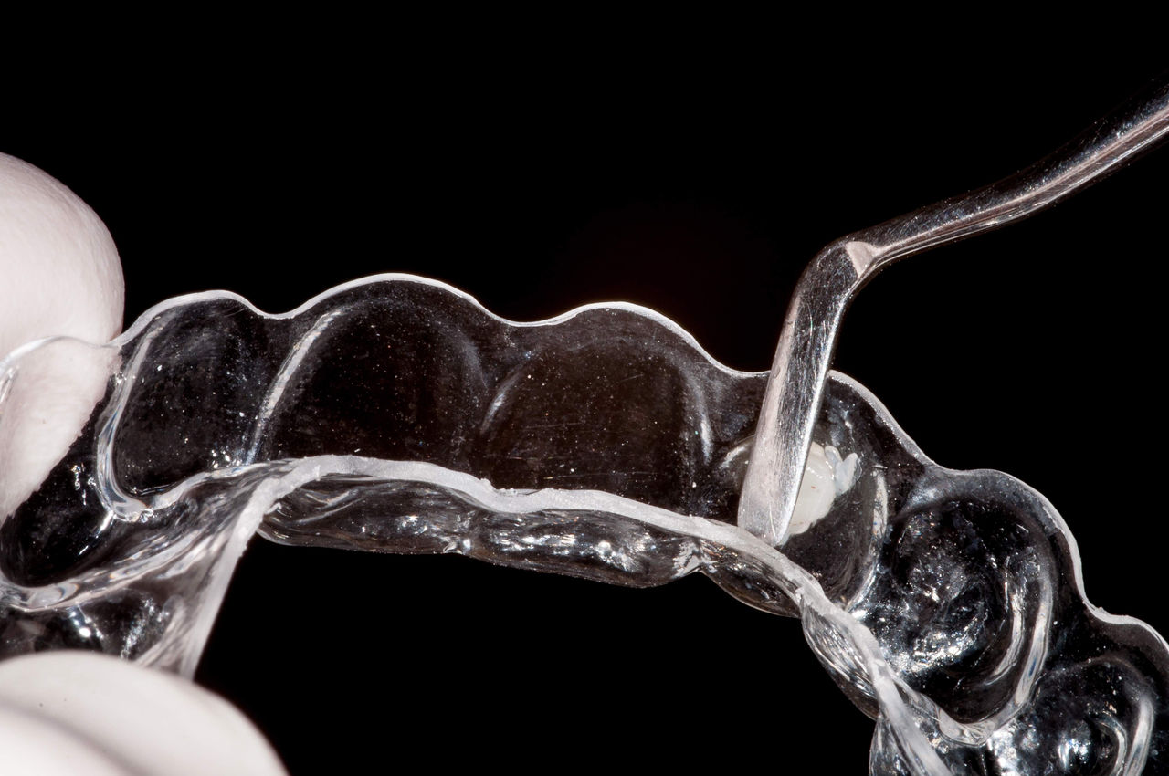 SureSmile Attachment Bonding with Ceram.x Spectra® ST | Dentsply Sirona ...