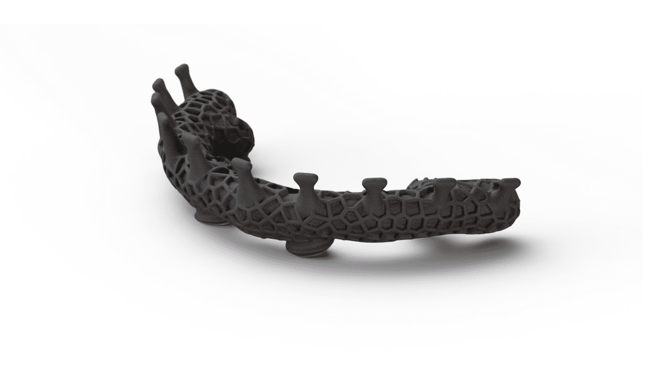 Atlantis Suprastructures | Dentsply Sirona Australia