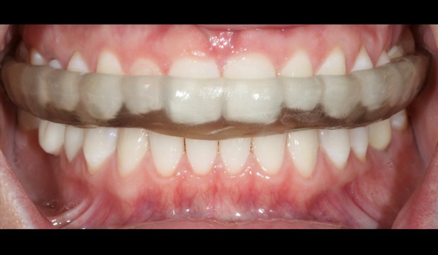 Primeprint Clinical Cases | Dentsply Sirona Australia