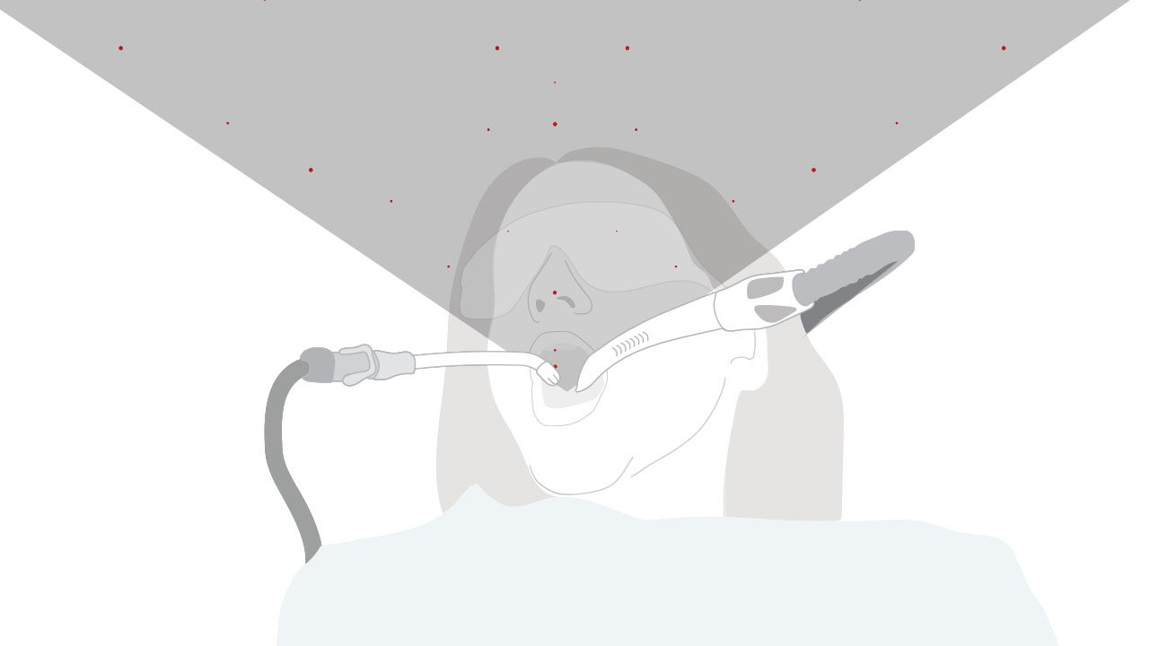 Purevac HVE System | Dentsply Sirona