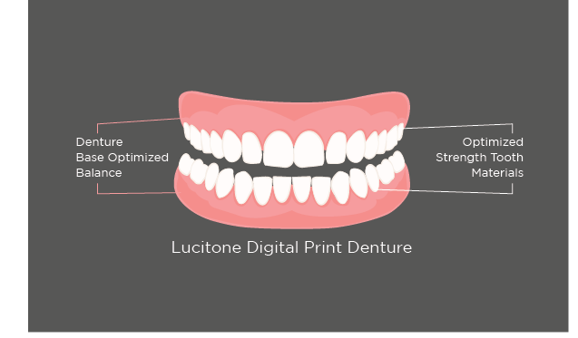 Why balance is important in a 3D Printed Denture BA