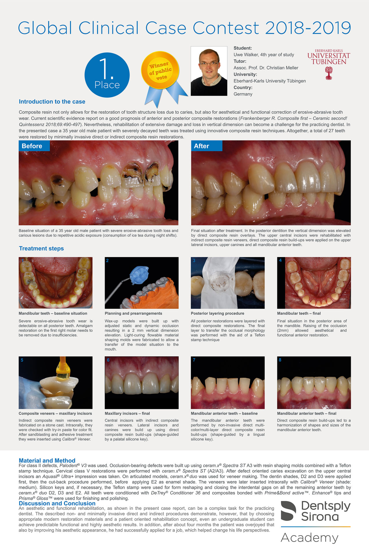 GCCC Global Clinical Case Contest I Dentsply Sirona Canada