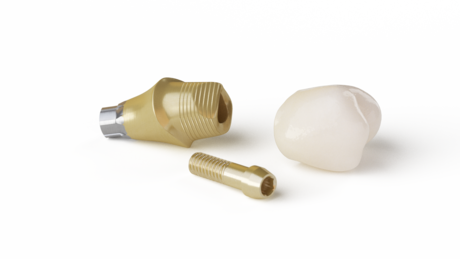 Implants Warranty Program | Dentsply Sirona Denmark