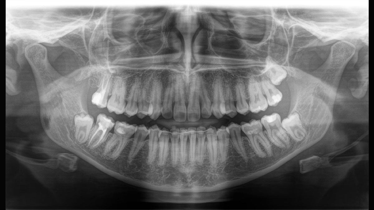 Orthophos SL 3D & 2D: X-Ray Machines | Dentsply Sirona Finland