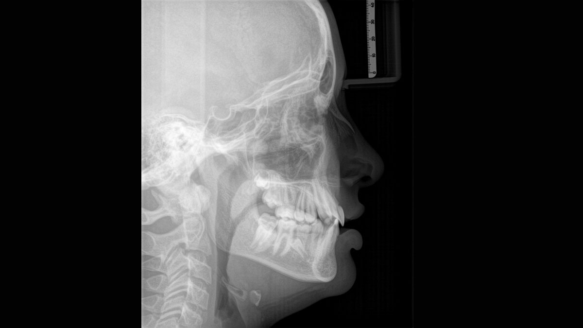 Orthophos SL 3D & 2D: X-Ray Machines | Dentsply Sirona Finland