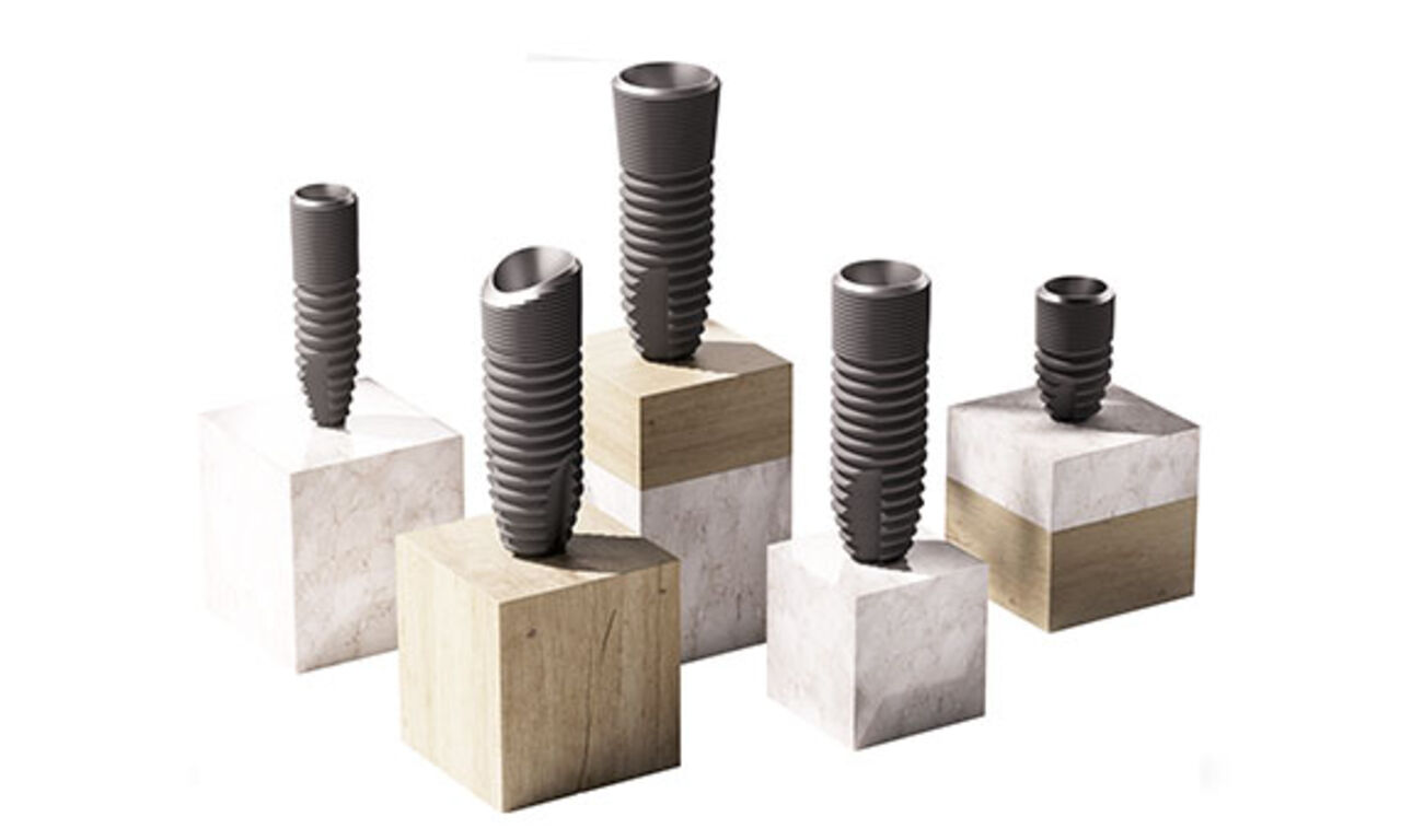 EV Prosthetics | Dental Implant | Dentsply Sirona Finland