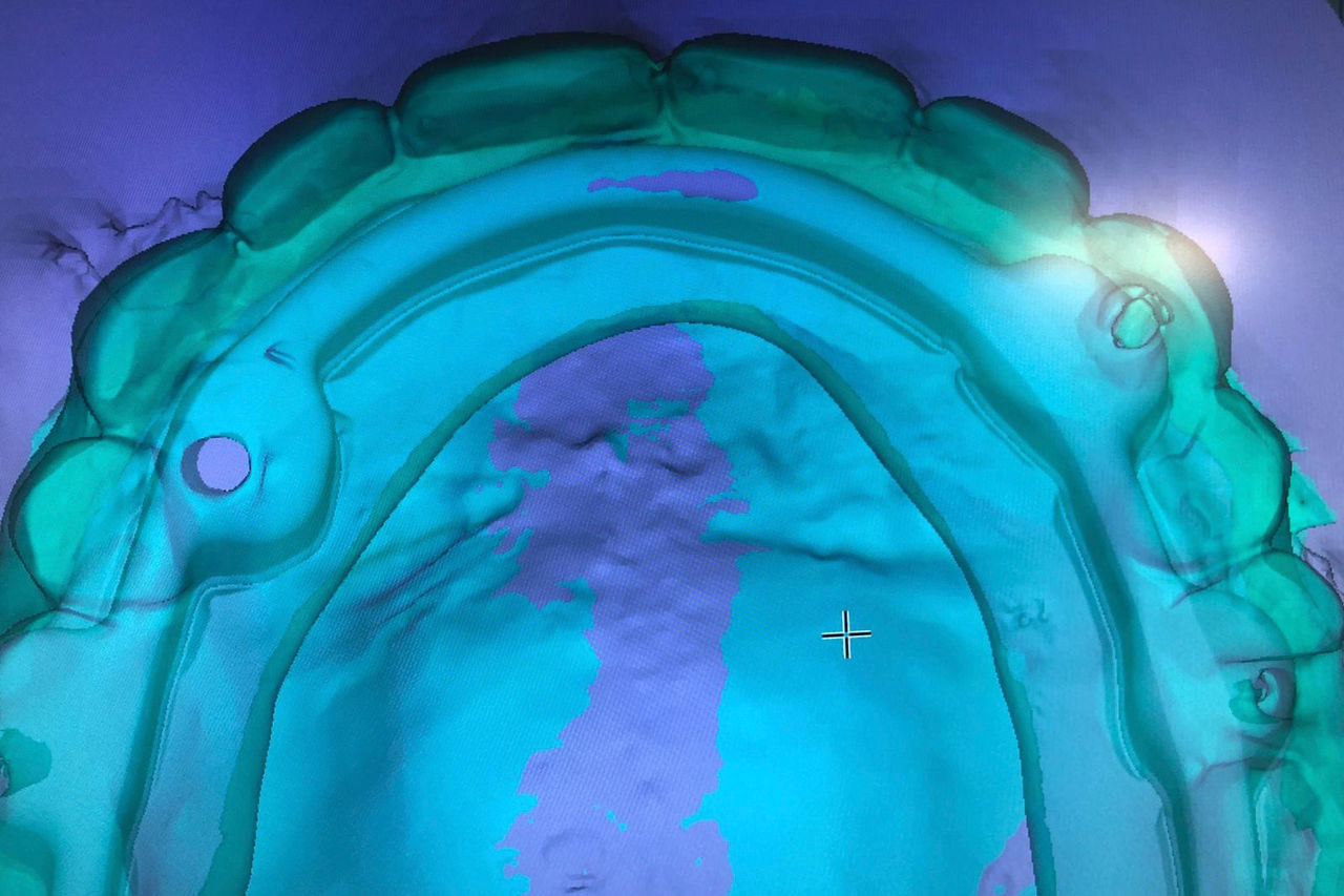 Atlantis Solutions Case Study Review | Dentsply Sirona UK