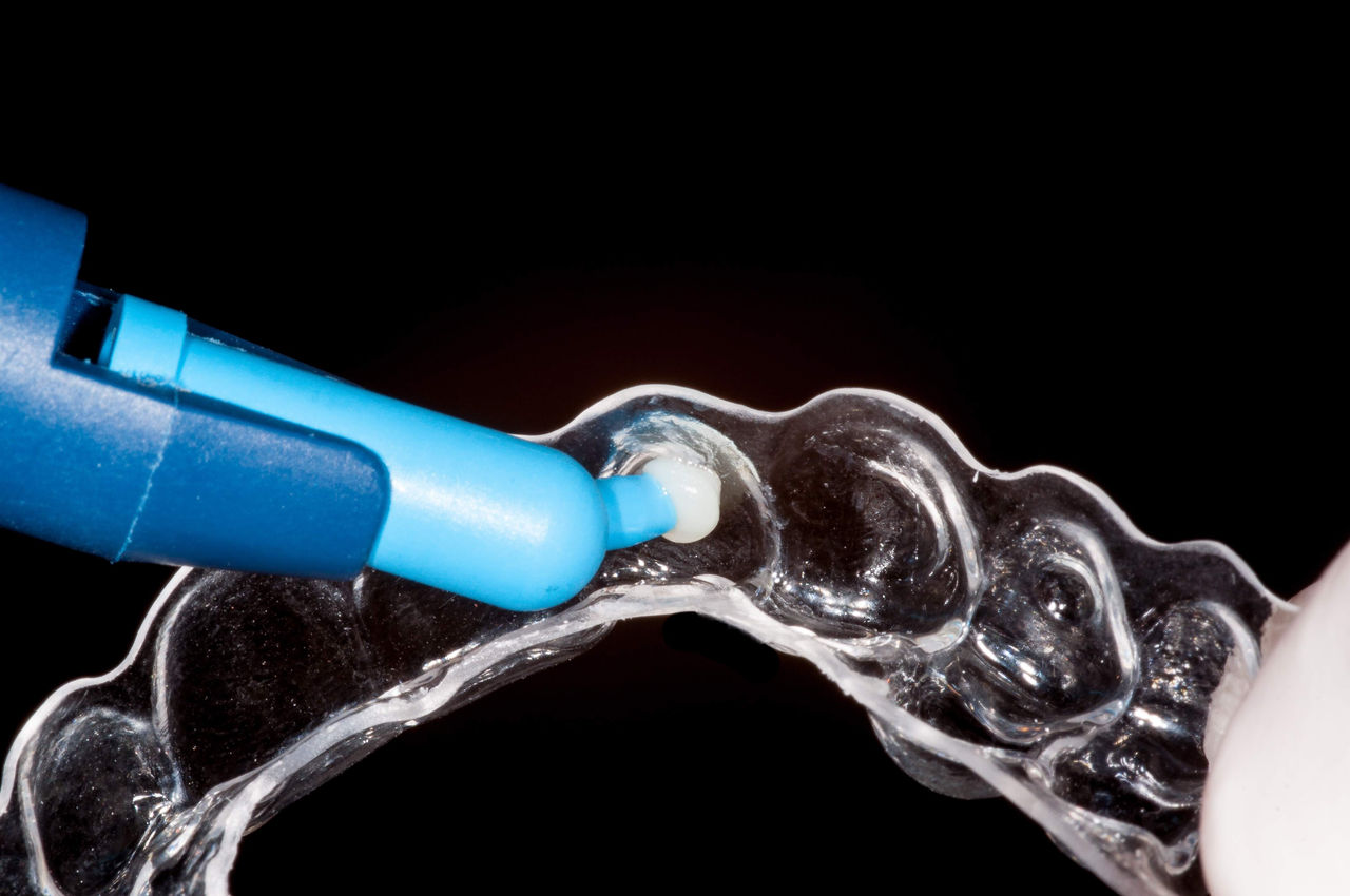 SureSmile Attachment Bonding with Ceram.x Spectra® ST | Dentsply Sirona UK