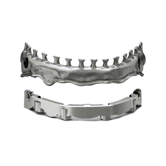 Atlantis Suprastructures | Dentsply Sirona UK