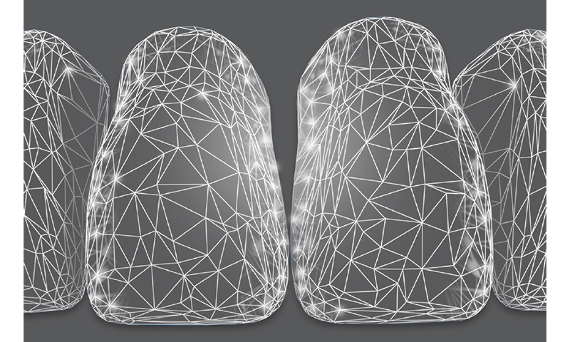 Premium 3D Printed Teeth with Lucitone Digital IPN | Dentsply Sirona UK
