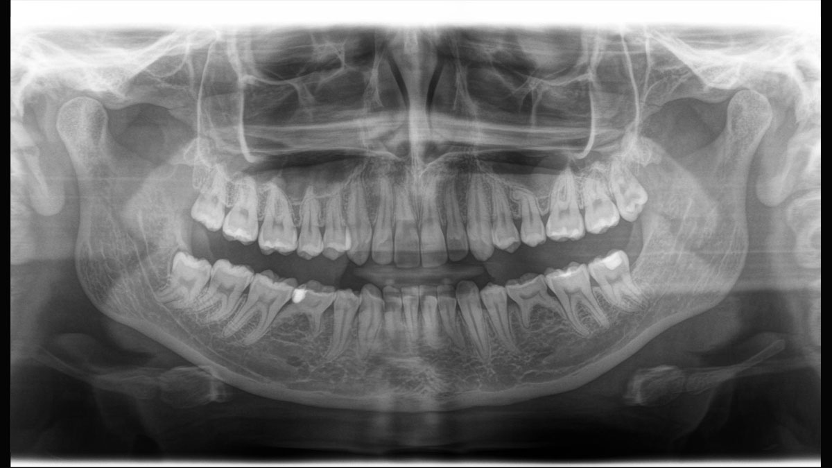 Orthophos SL 3D & 2D: X-Ray Machines | Dentsply Sirona UK