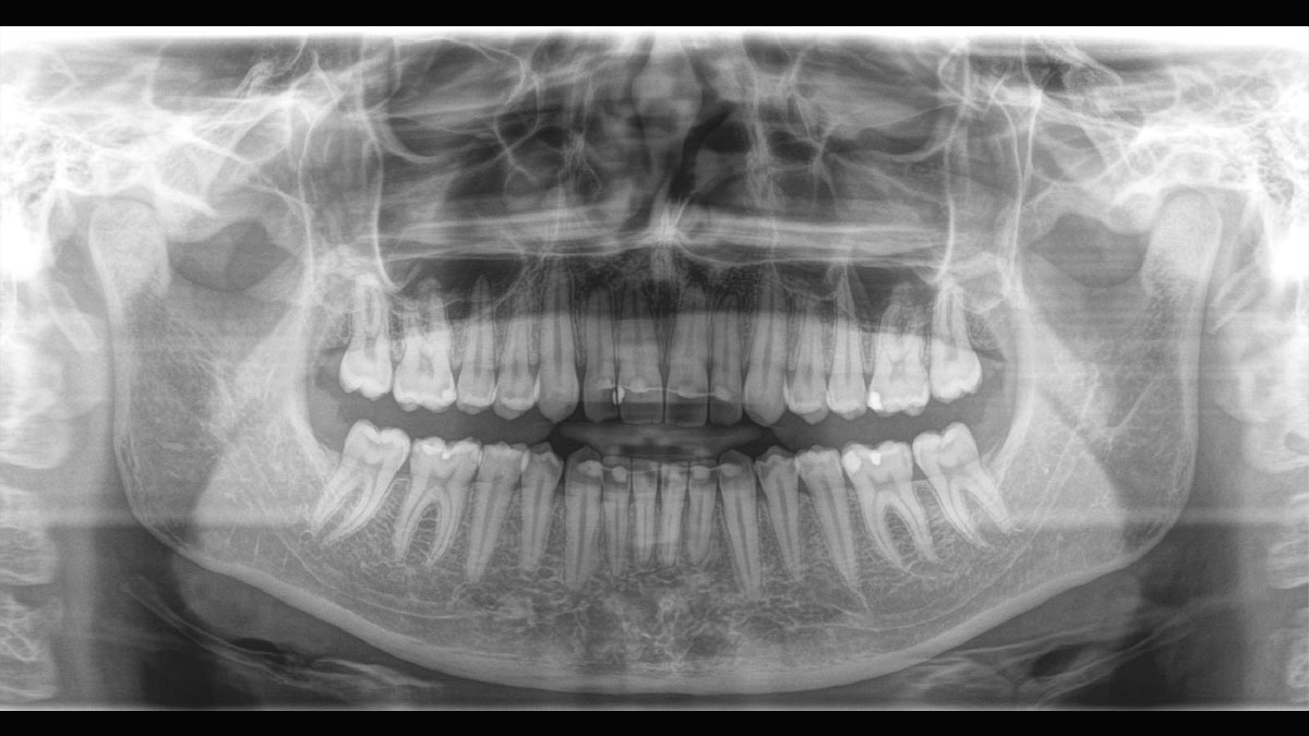 Orthophos SL 3D & 2D: X-Ray Machines | Dentsply Sirona UK