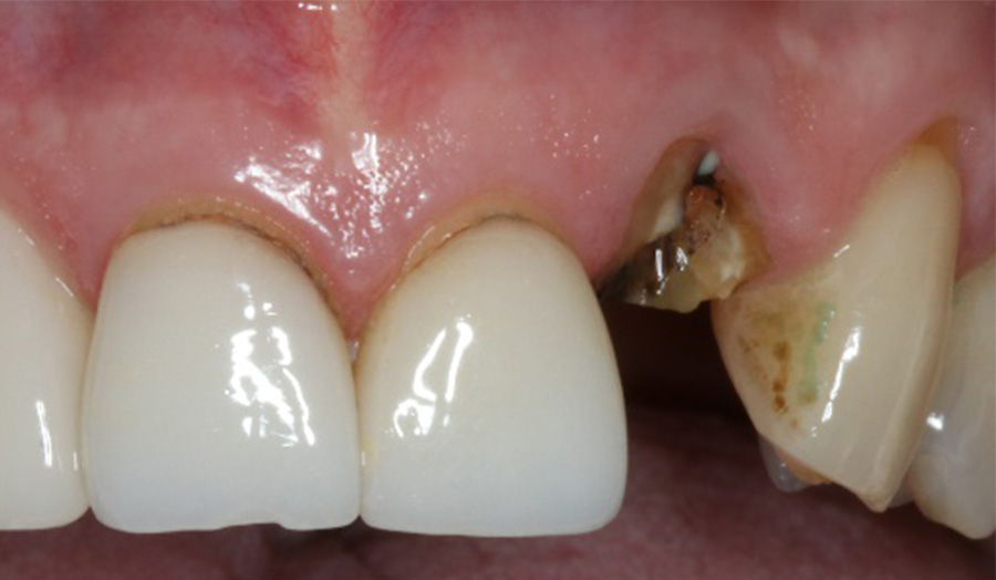 Primeprint Clinical Cases | Dentsply Sirona UK