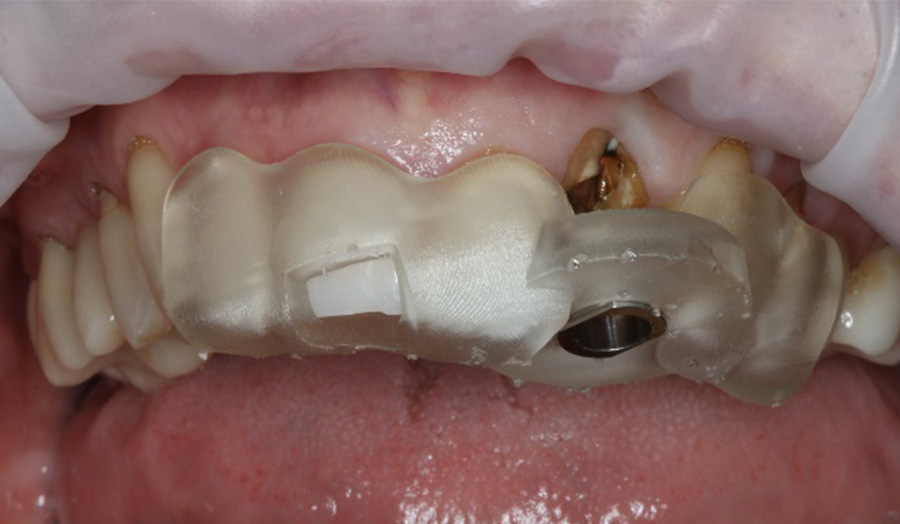 Primeprint Clinical Cases | Dentsply Sirona UK