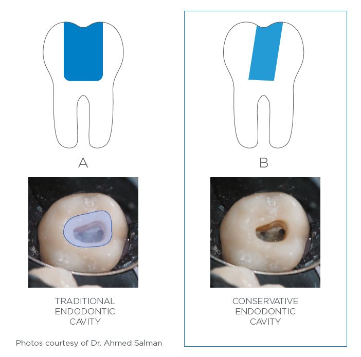 TruNatomy Endodontic Files | Dentsply Sirona UK