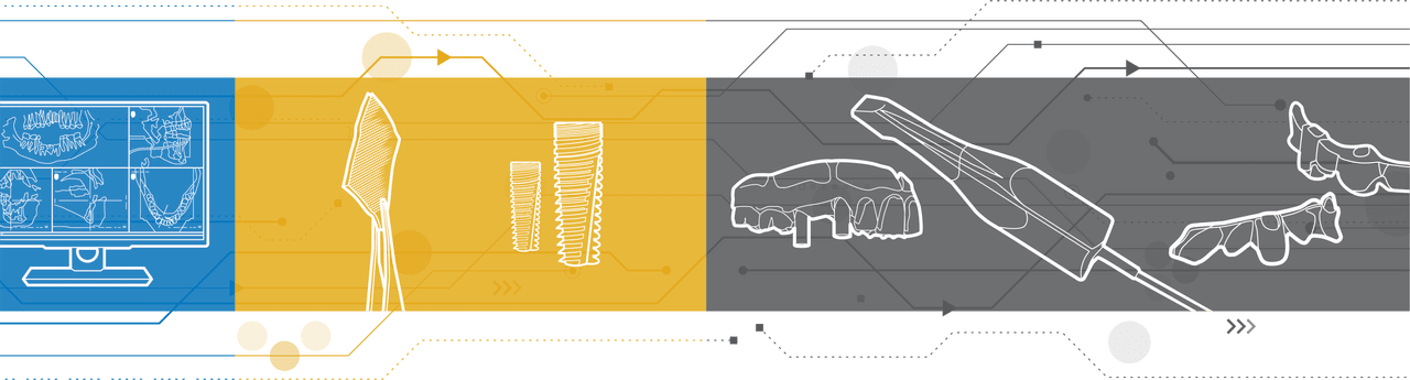 Partial Tooth Replacement Workflow | Dentsply Sirona UK