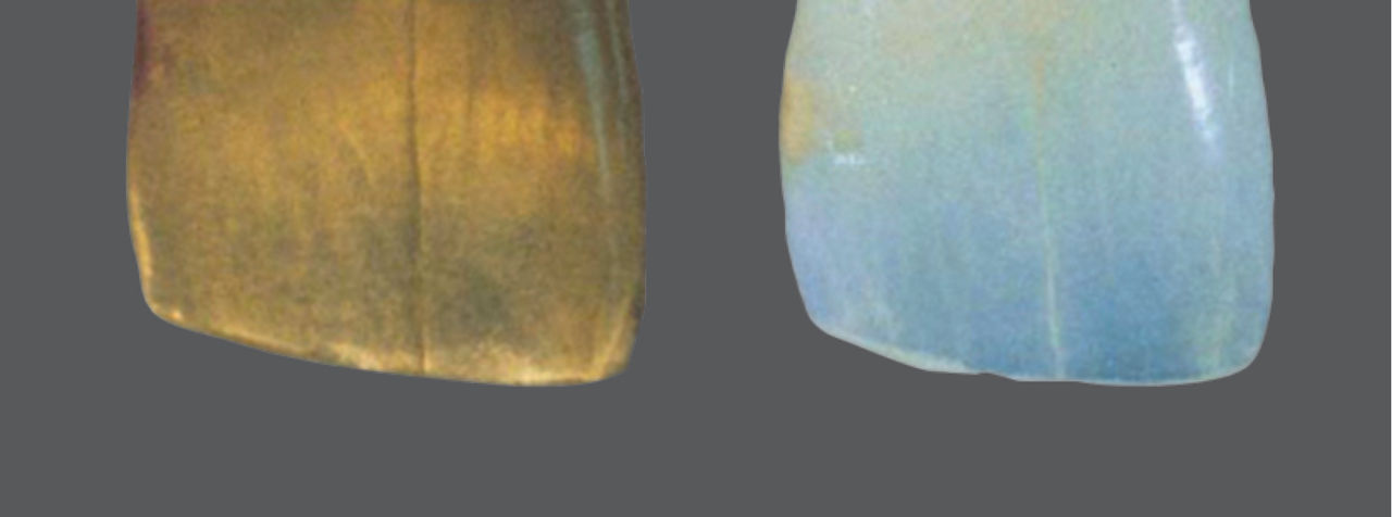 Celtra Duo Blocks | Dentsply Sirona