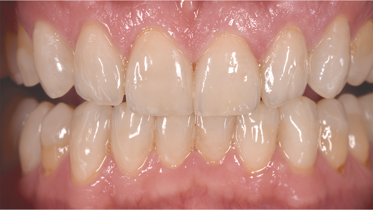 Celtra Press | Dentsply Sirona Croatia