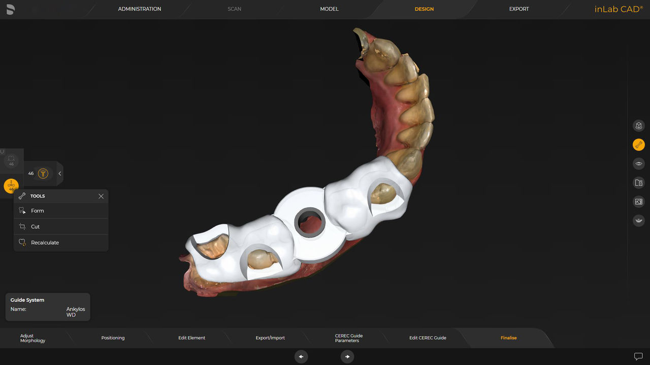 inLab Software: Dental CAD Software | Dentsply Sirona