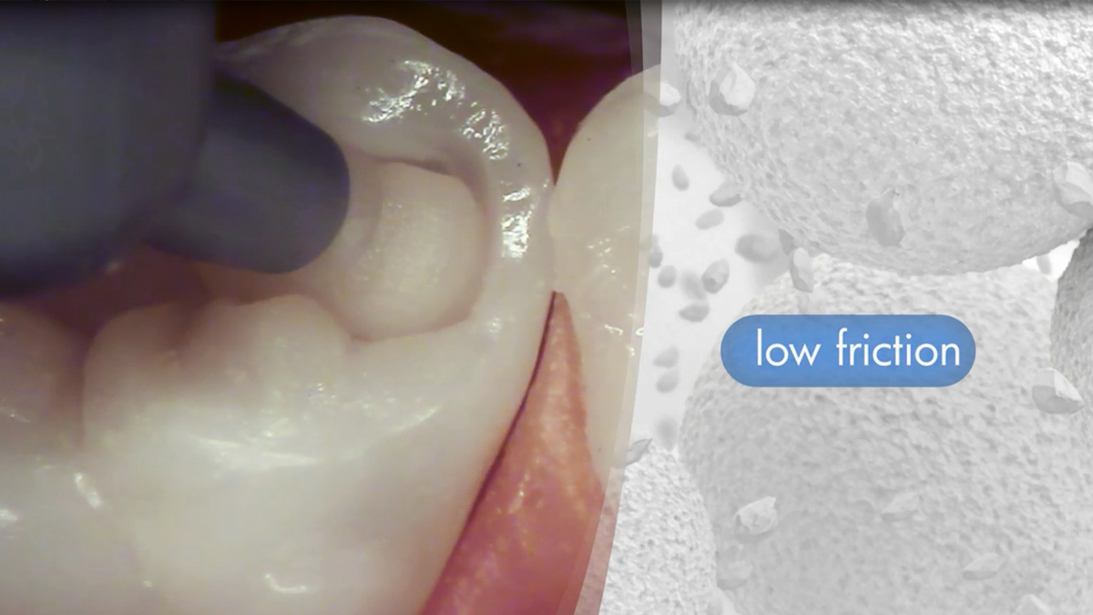 Neo Spectra® ST | Dentsply Sirona Croatia