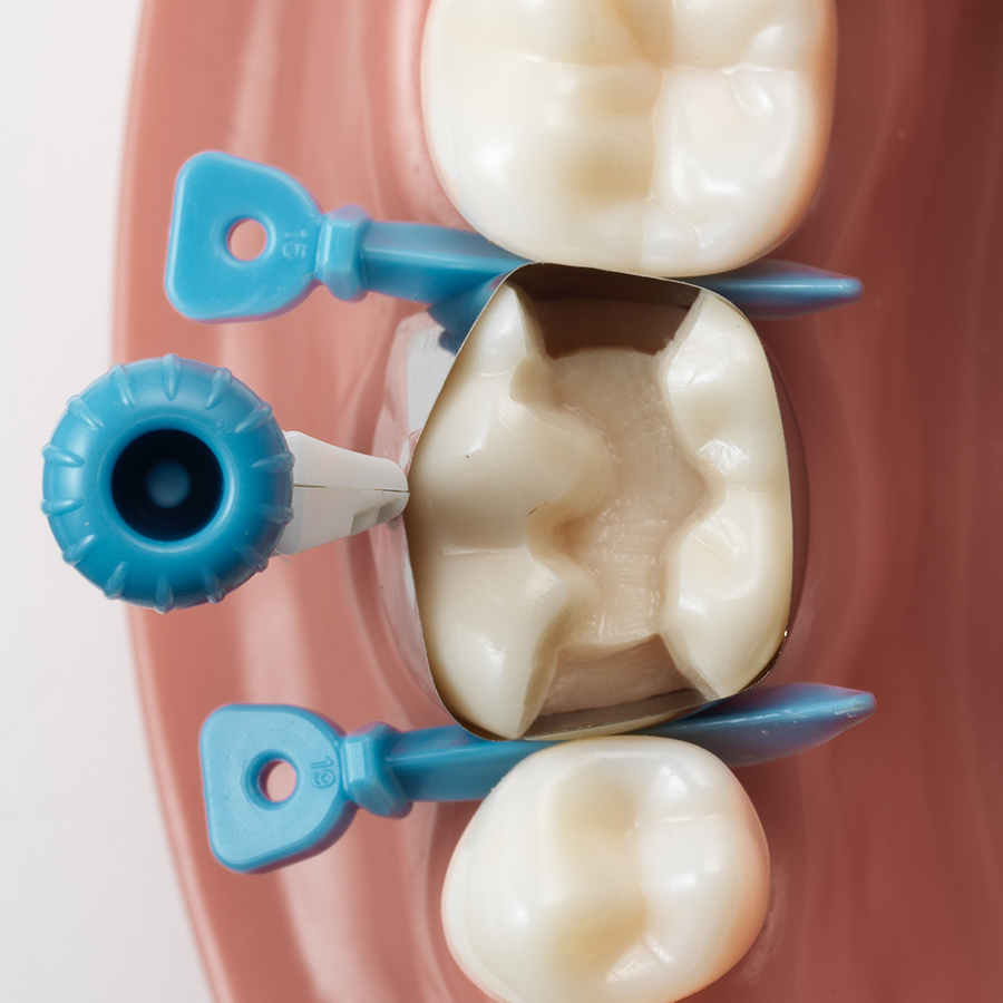 Palodent 360: Circumferential Matrix System | Dentsply Sirona