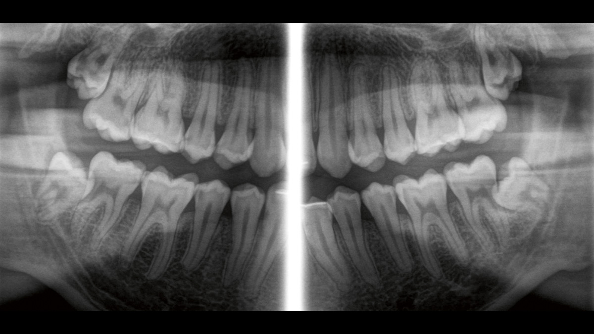 Orthophos SL 3D & 2D: X-Ray Machines | Dentsply Sirona India